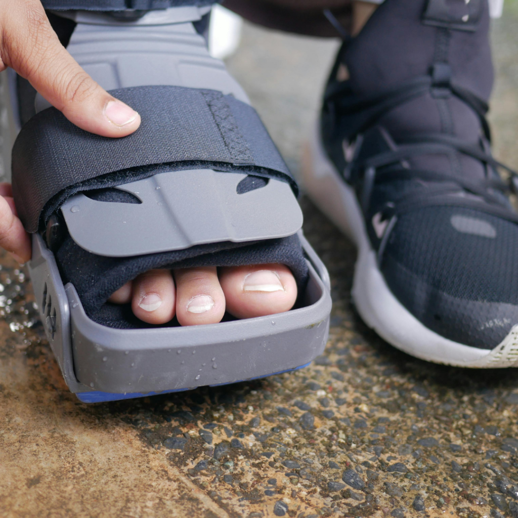 Best Orthopedic for Fracture Care and Trauma Management in Bangalore ...